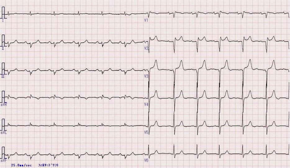 松下心電塾 Matsushita ECG School